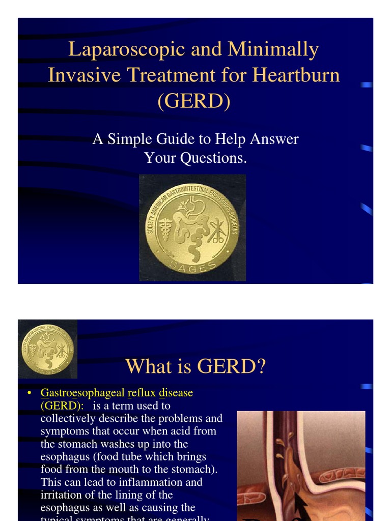 Gerd PDF | PDF | Gastroesophageal Reflux Disease | Esophagus