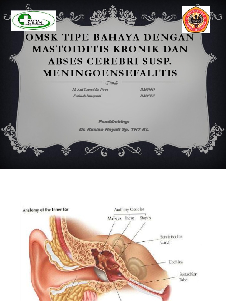 Omsk Tipe Bahaya Dengan Mastoiditis Kronik Dan Abses | PDF