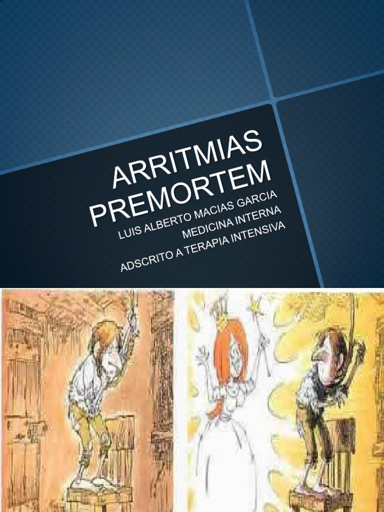 Arritmias ISEM | PDF