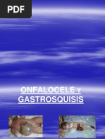 Onfalocele | PDF | Abdomen | Hospital