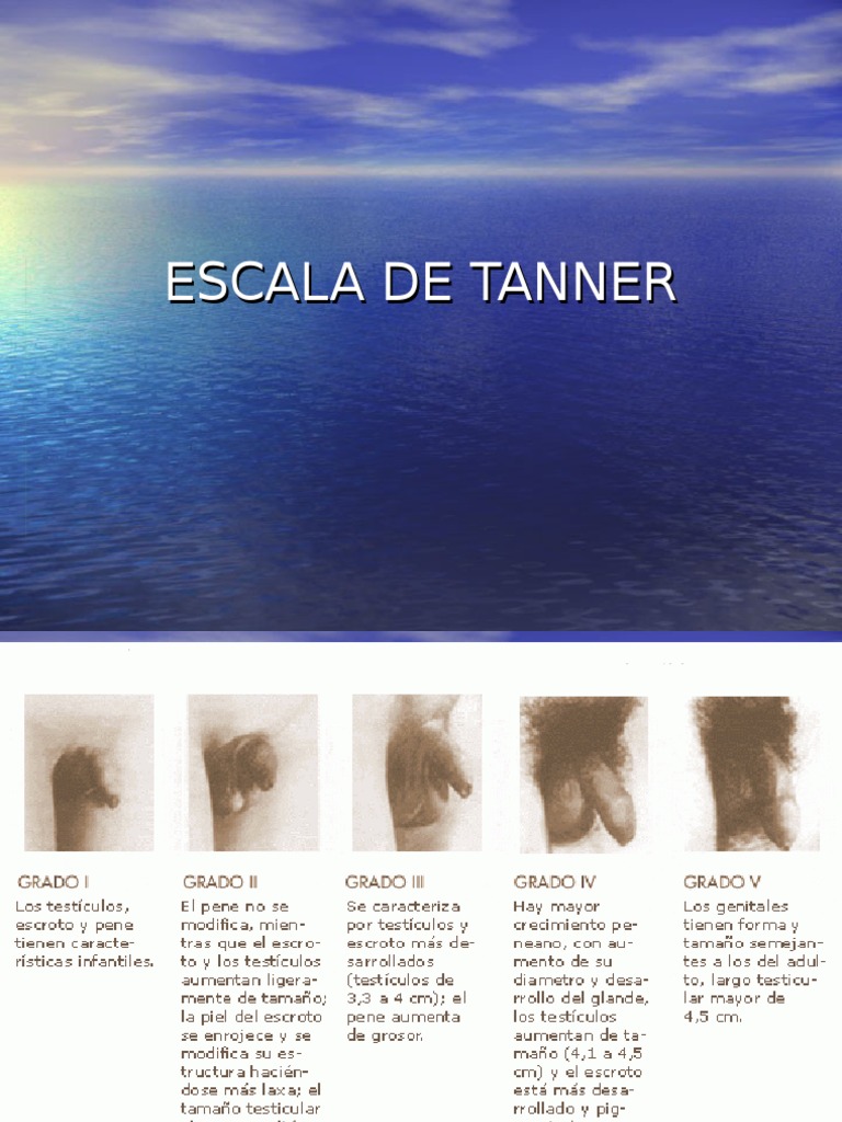 Escala de Tanner | PDF