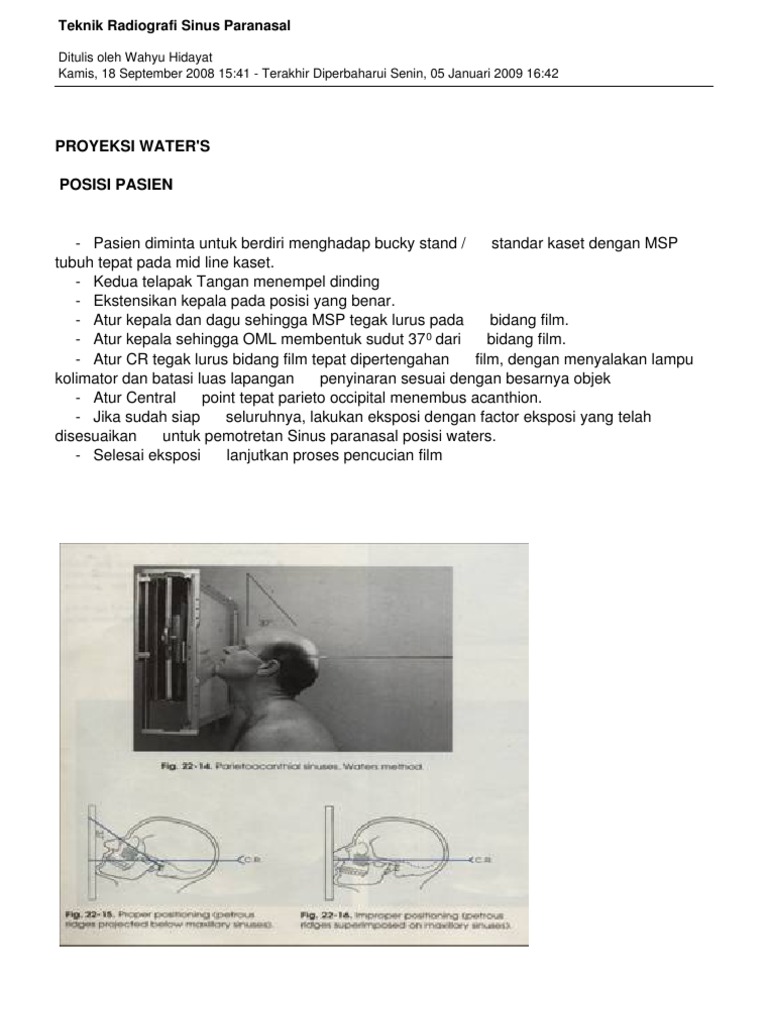 Teknik Radiografi Sinus Paranasal | PDF | Sains & Matematika