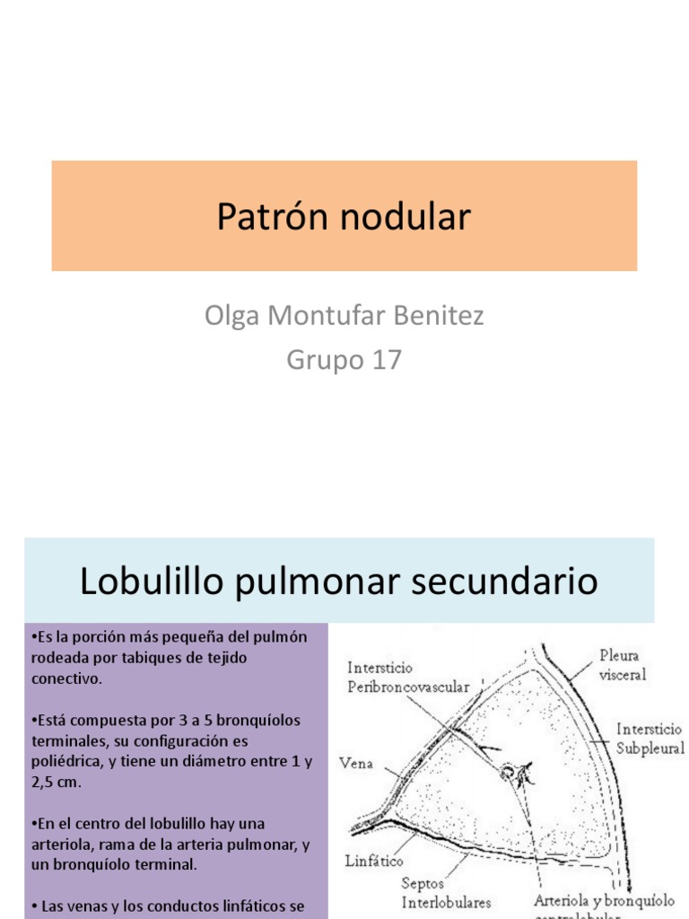 Patrón Nodular | PDF