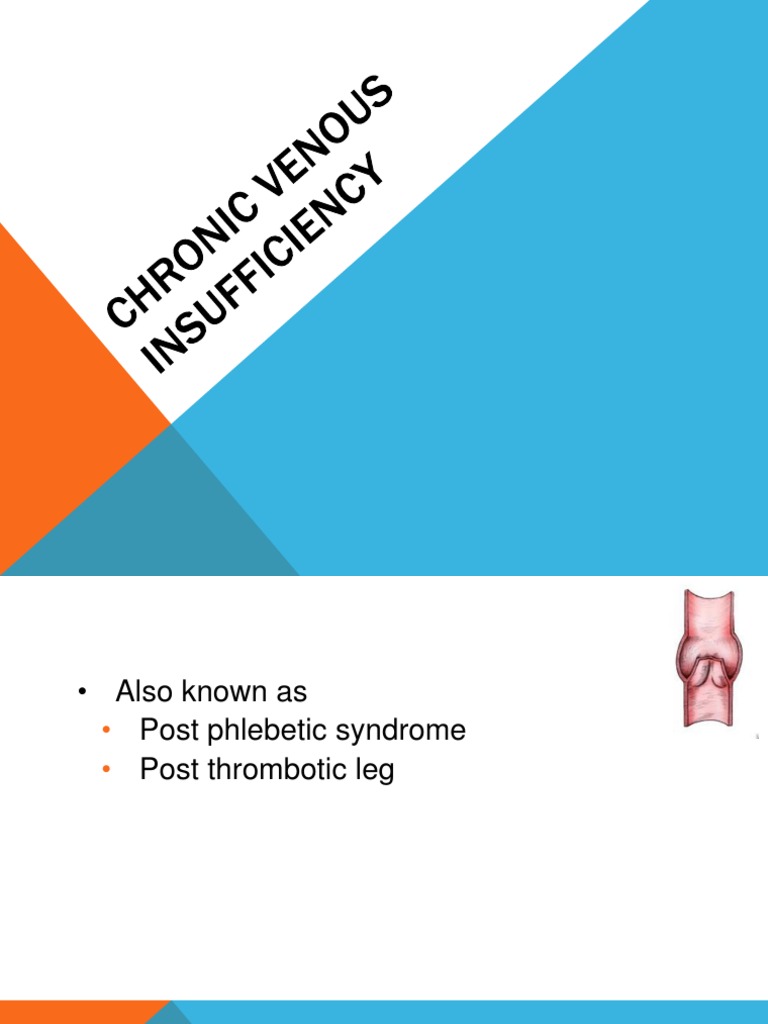 Post-thrombotic syndrome and venous leg ulcer causes and treatment | PDF