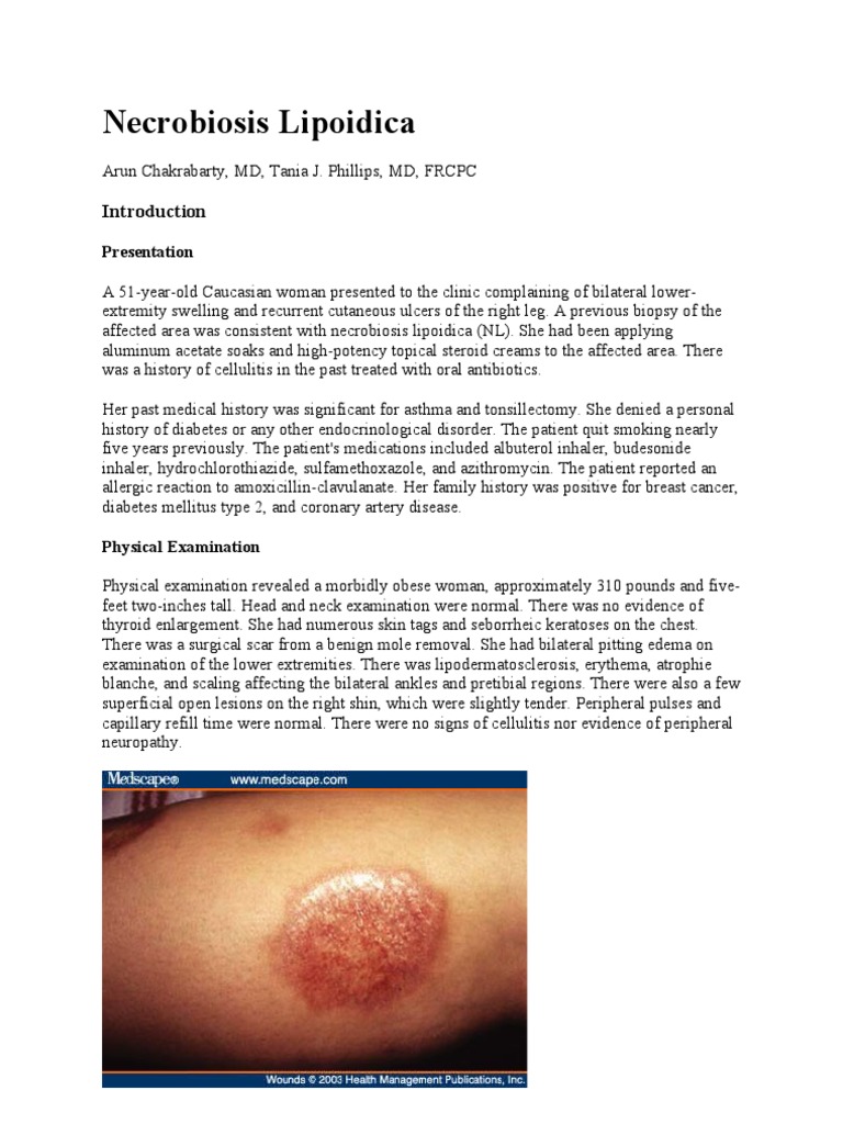 Necrobiosis Lipoidica | PDF | Medical Specialties | Clinical Medicine