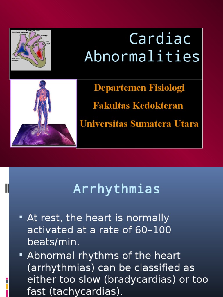 Understanding Cardiac Arrhythmias | PDF | Heart | Cardiovascular System