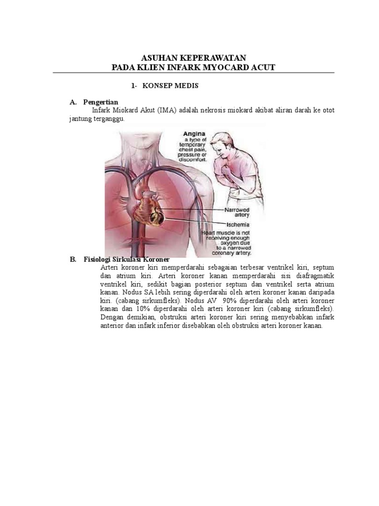 Asuhan Keperawatan Klien Dengan Infark Myocard Acut | PDF