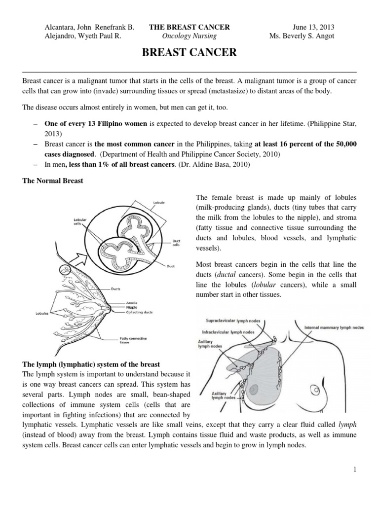 Breast Cancer Overview and Insights | PDF | Wellness