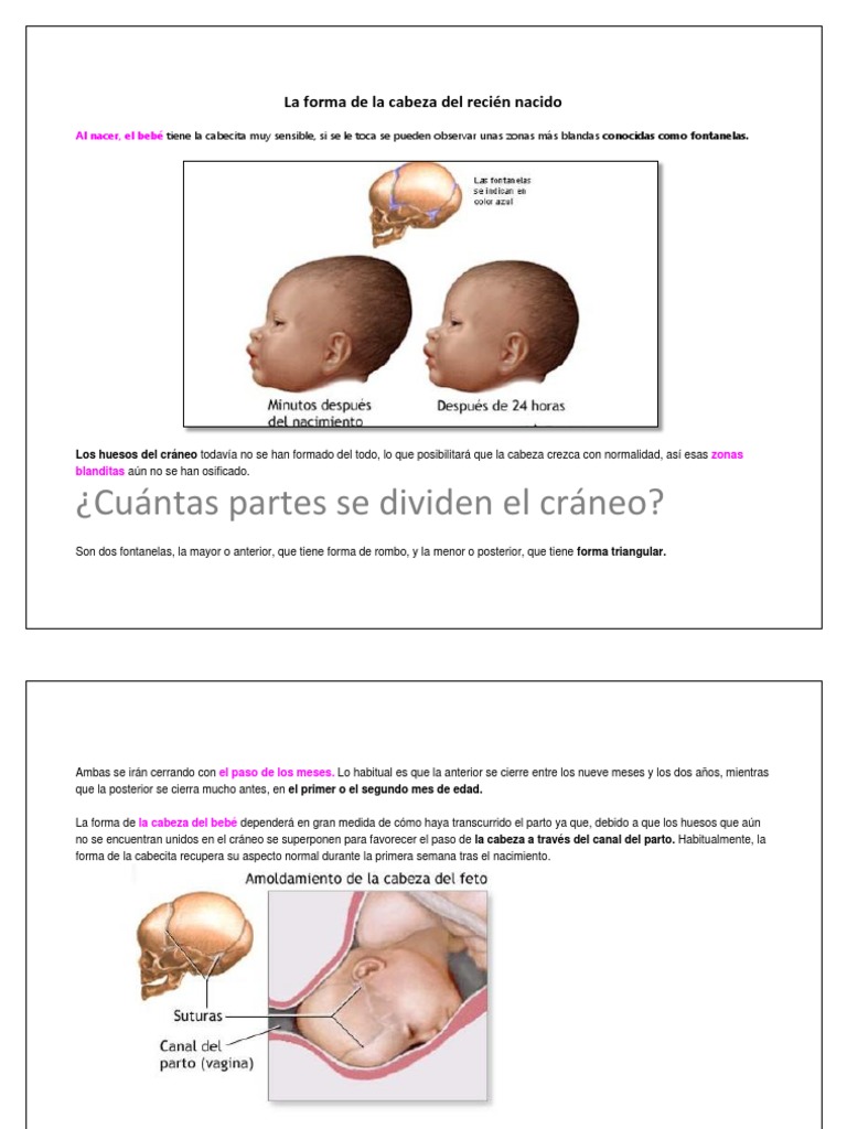 La Forma de La Cabeza Del Recién Nacido | PDF | Cráneo | Parto