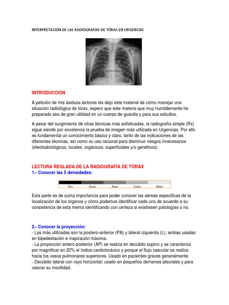 Interpretación de Las Radiografías de Tórax en Urgencias | PDF | Pulmón | Aorta
