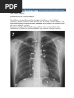 Cápsula de Glisson y su función hepática | PDF | Tejido adiposo | Riñón