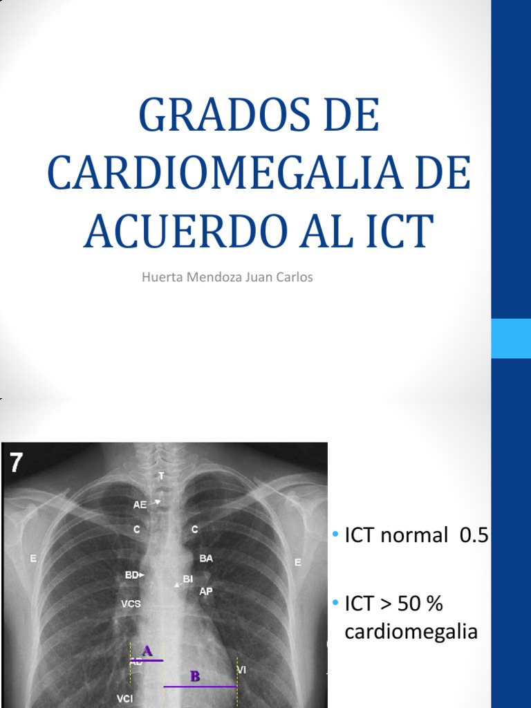 Grados de Cardiomegalia según ICT | PDF