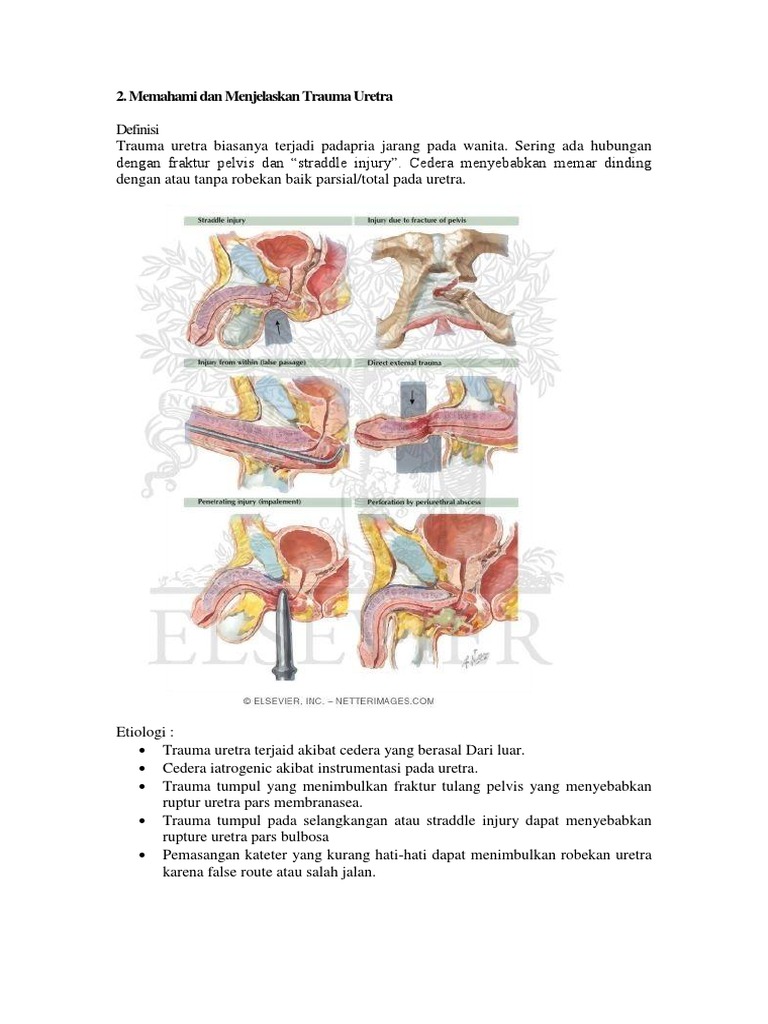 Trauma Uretra | PDF | Seni | Kesehatan Holistik