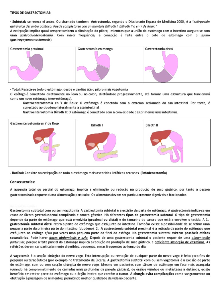 Antrectomia | PDF | Estômago | Trato gastrointestinal