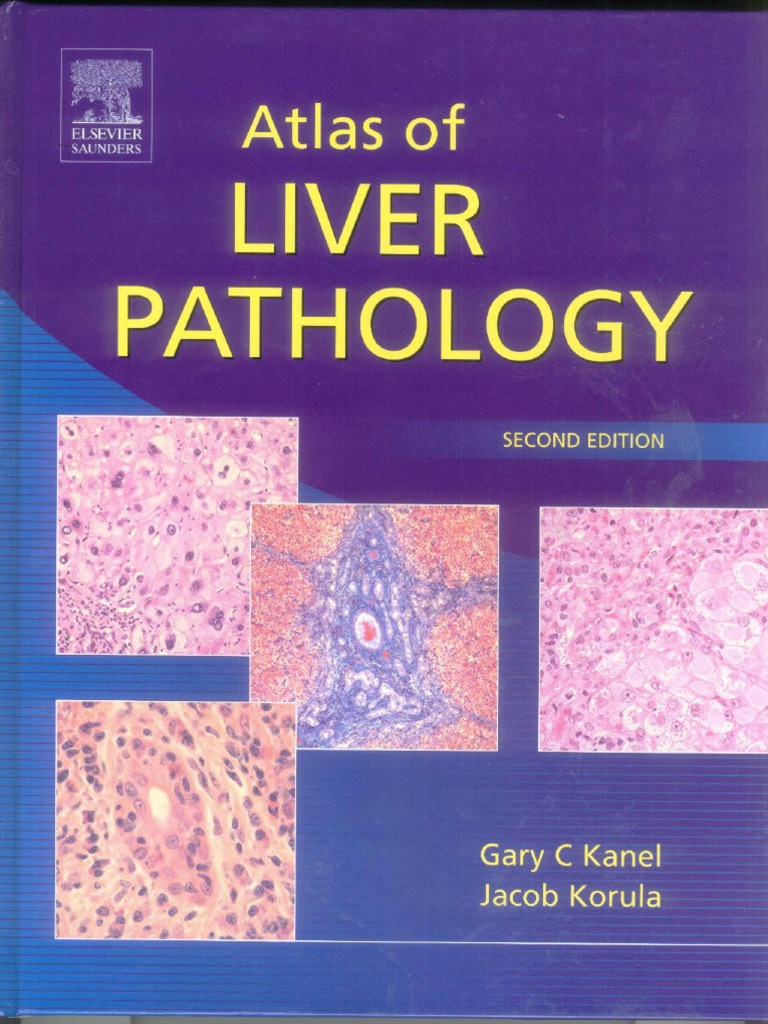 Atlas of Liver Pathology | PDF