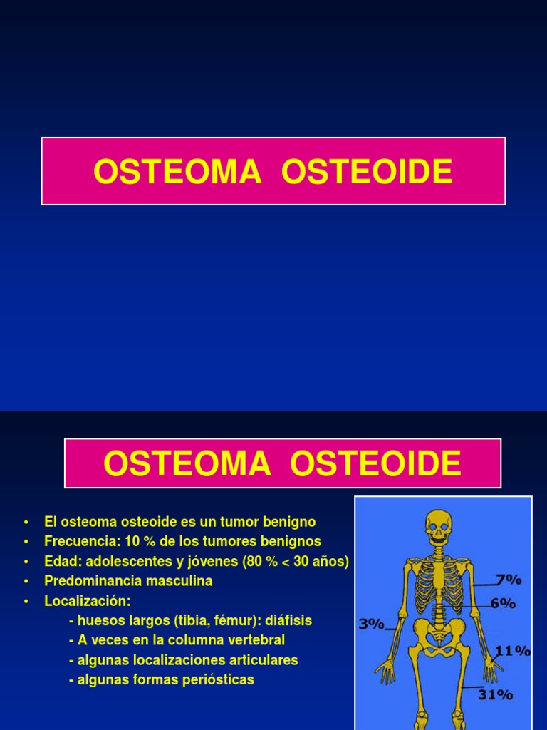 02 - Osteoma Osteoide | PDF | Hueso | Sistema musculoesquelético