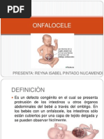 Onfalocele | PDF | Abdomen | Hospital