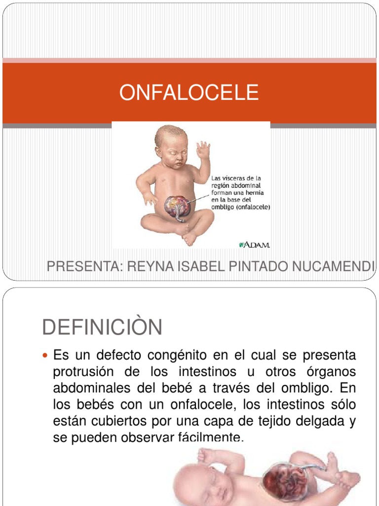 Un análisis completo del defecto congénito onfalocele: sus causas ...