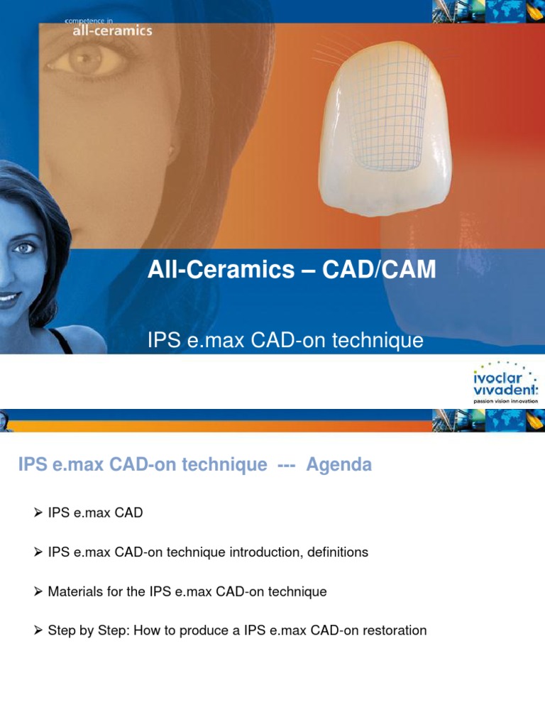 IPS e.max CAD-On Technique - September 2010_e | Ceramics | Materials