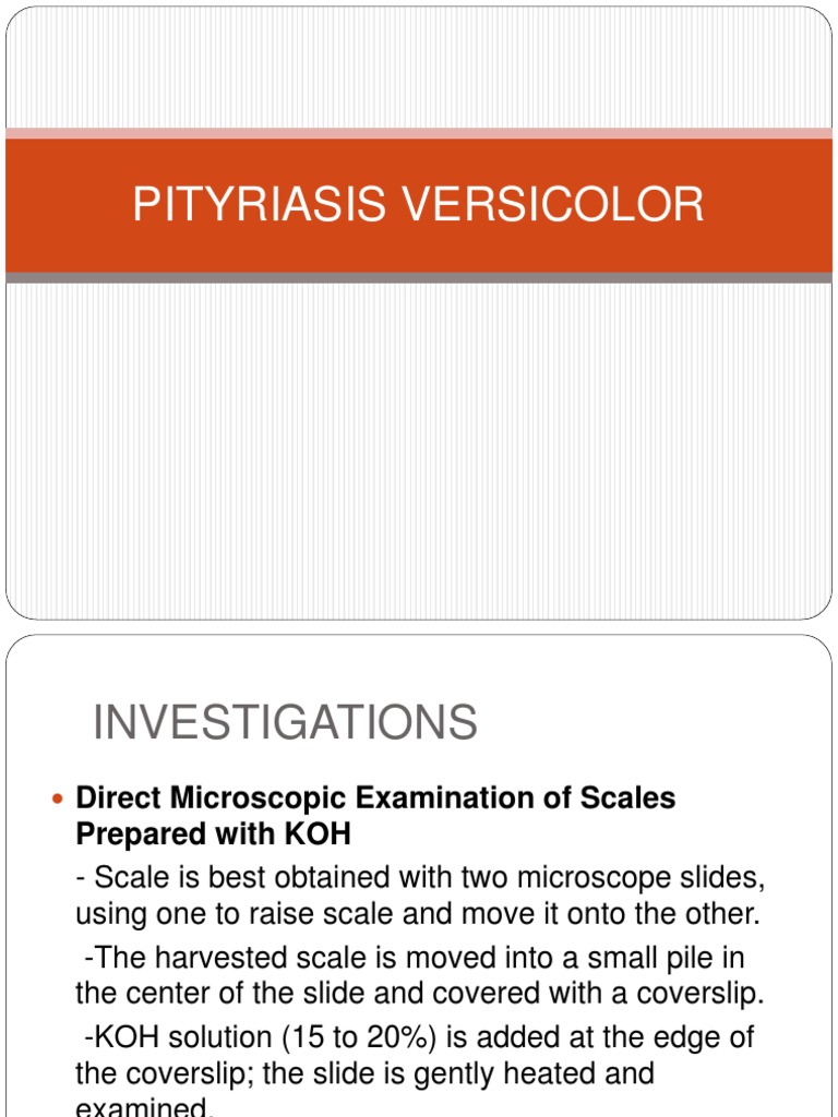 Pityriasis Versicolor Diagnosis & Treatment | PDF | Cooking, Food & Wine