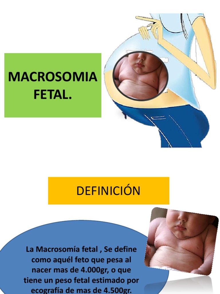 Macrosomia Er | PDF | El embarazo | Parto