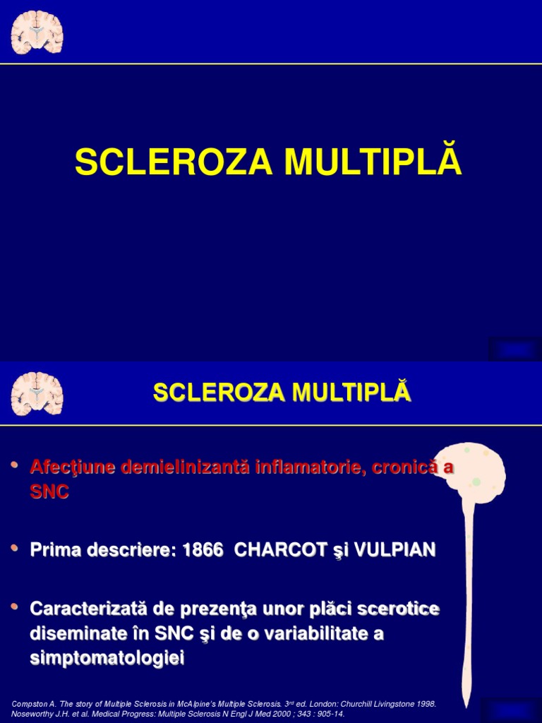 Scleroza Multipla | PDF