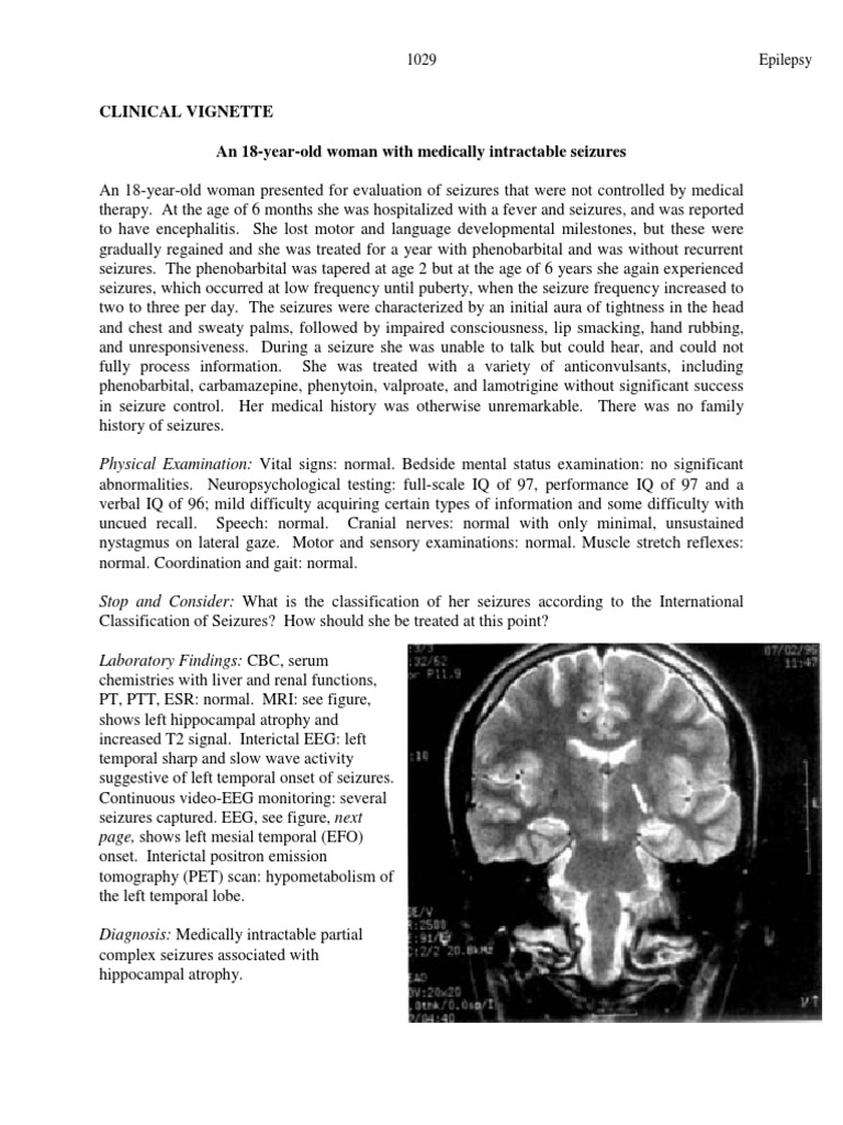 seizure pathophysiology | Epilepsy | Coma