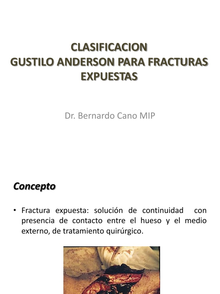 Clasificacion Gustilo | PDF | Anatomía humana | Medicina CLINICA