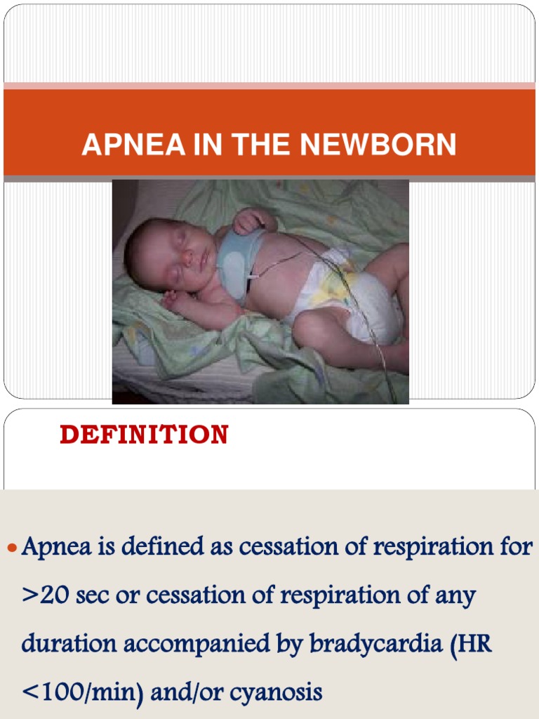 Understanding Neonatal Apnea | PDF | Apnea | Respiratory Tract