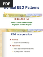 Eeg Report Formate | PDF | Electroencephalography | Epilepsy