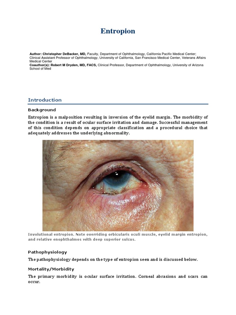 Entropion | PDF | Botulinum Toxin | Surgery