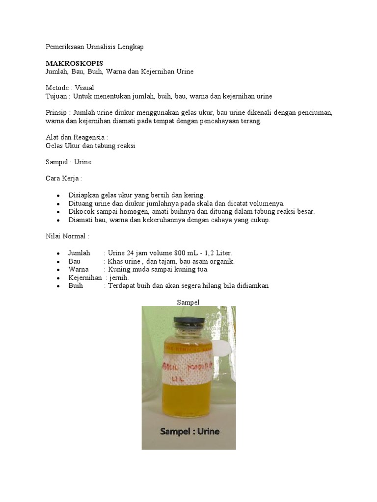 Pemeriksaan Urinalisis Lengkap | PDF
