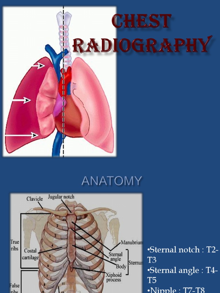 Chest Radiography | PDF | Lung | Thorax