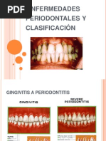 Clasificación de Winter | PDF | Ramas de Odontología | Boca
