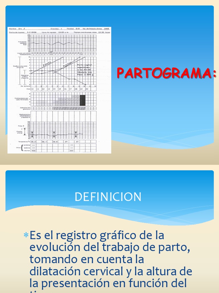PARTOGRAMA 1 | Parto | Especialidades Medicas