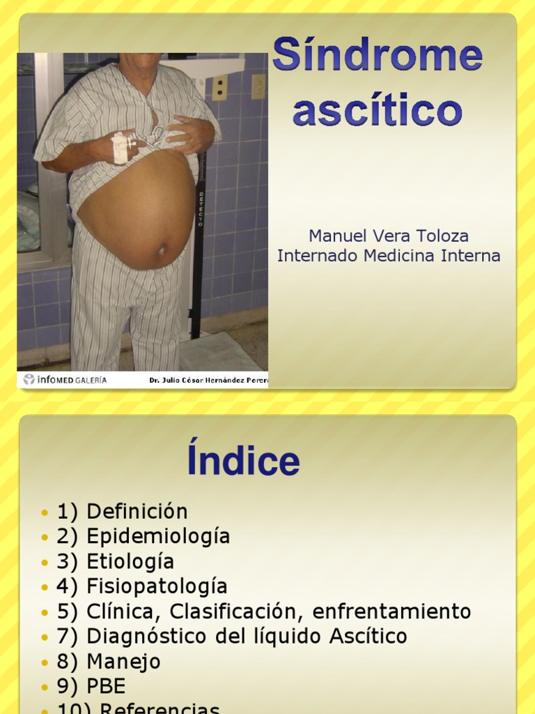 Síndrome Ascítico | PDF | Cirrosis | Enfermedades digestivas