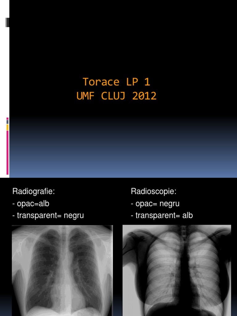 Torace (Radiologie, Imagistica) | PDF