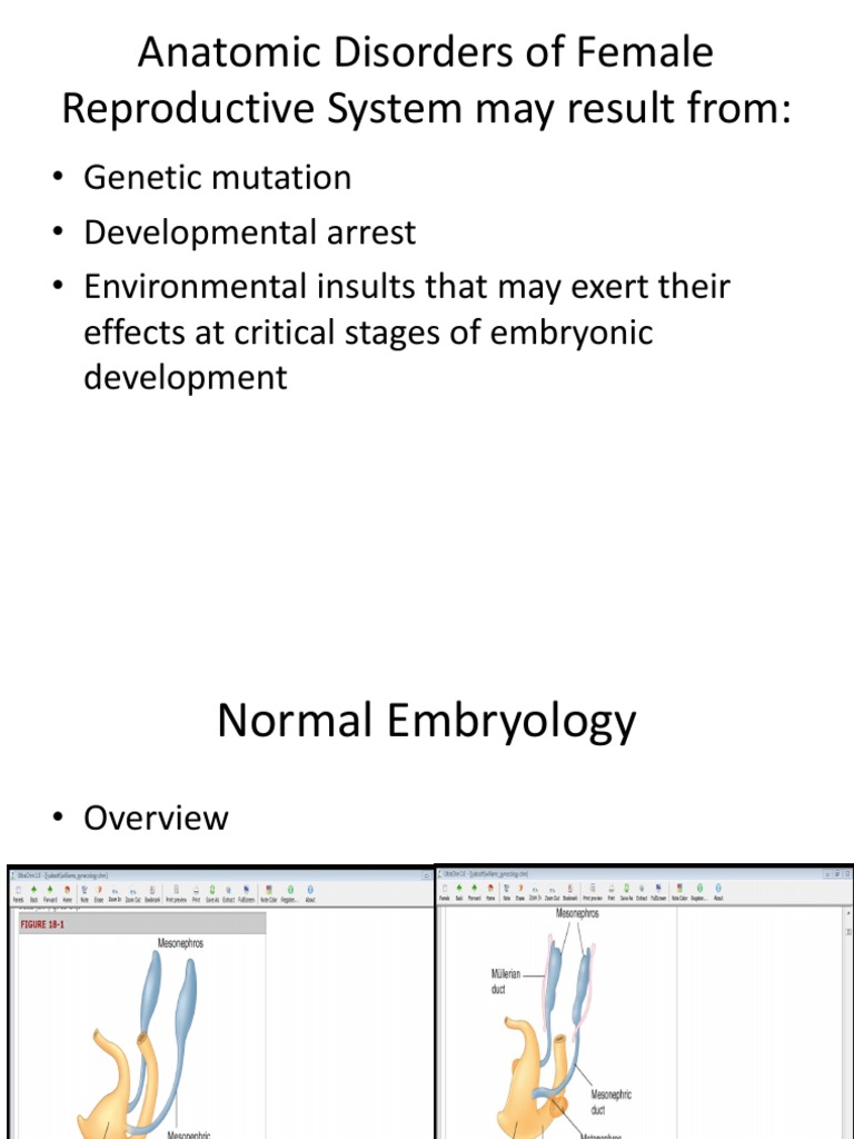 Anatomic Disorders of Female Reproductive System | Uterus | Vagina