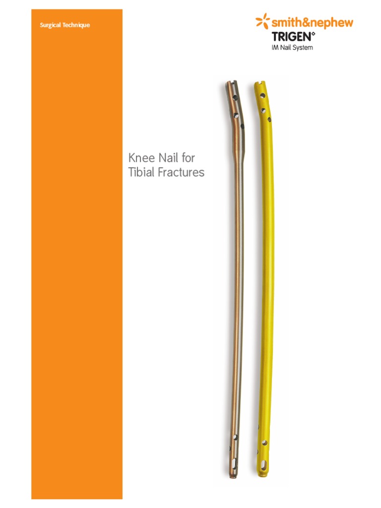 Trigen Tibial | PDF | Screw | Knee