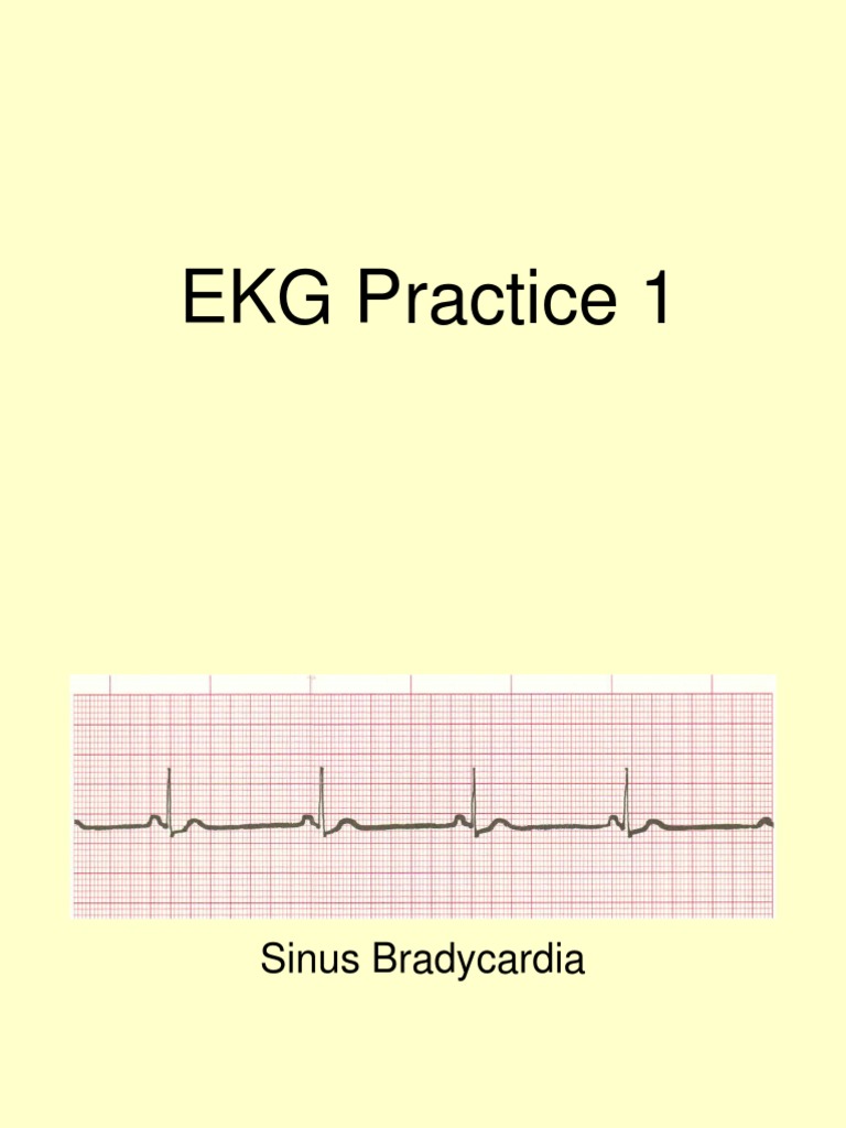EKG Practice Powerpoint