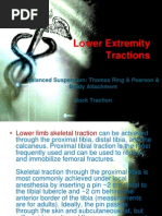 Sarmiento Cast for Tibial Fractures | PDF