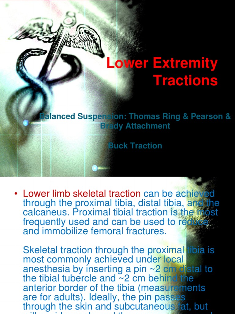 Lower Extremity Tractions: Balanced Suspension: Thomas Ring & Pearson ...