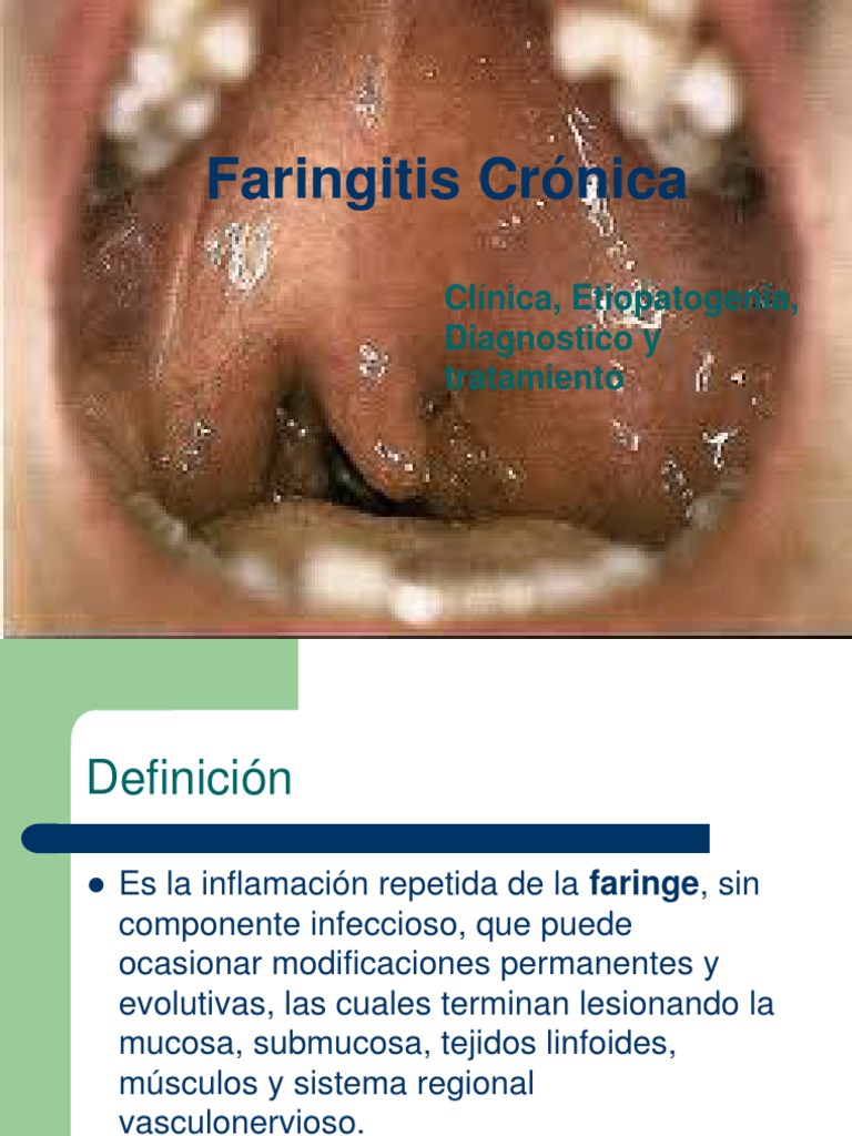 Faringitis Crónica: Síntomas y Tratamiento | PDF | Salud y bienestar