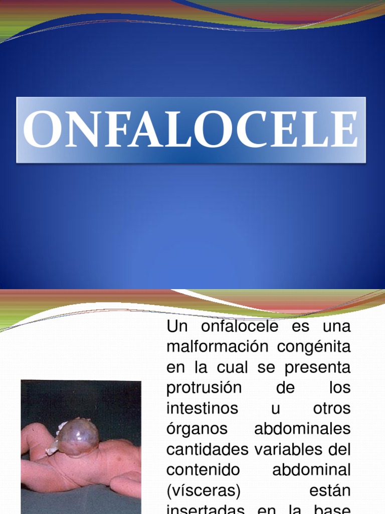 ONFALOCELE | PDF | Infantes | Parto