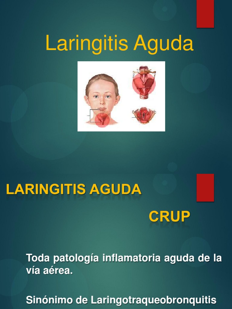 Laringitis | PDF | Rtt | Neumología