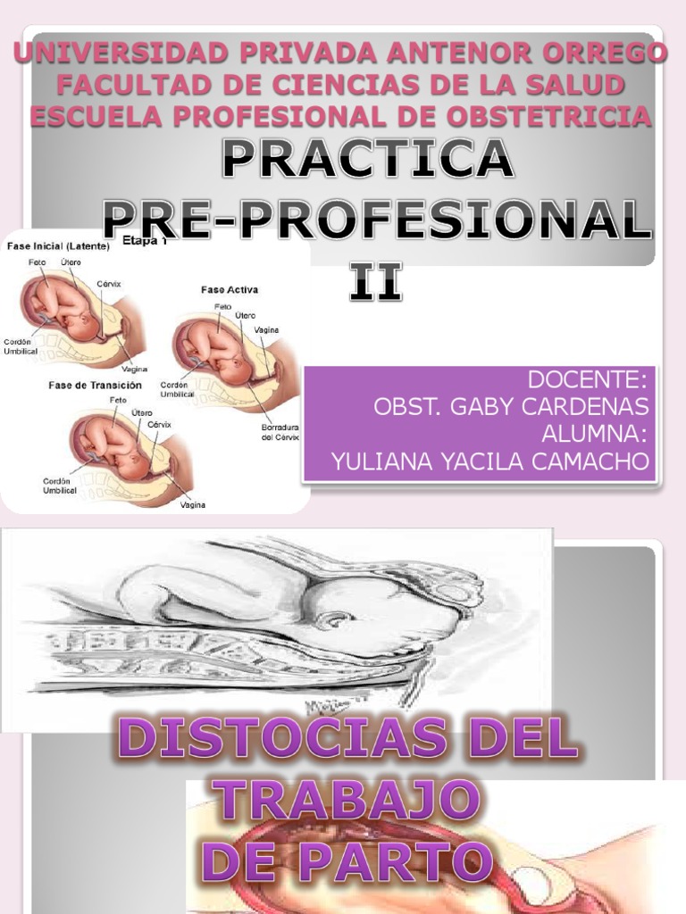 Distocias de Presentacion | Parto | Salud maternal