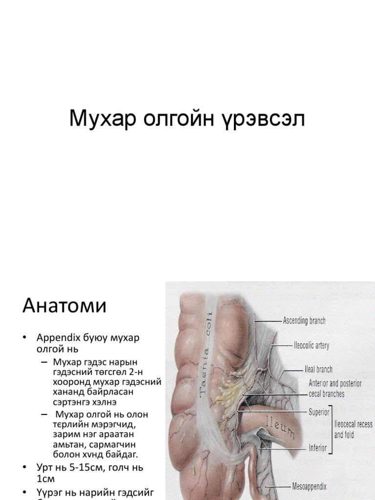 Acute Appendicitis Pdf