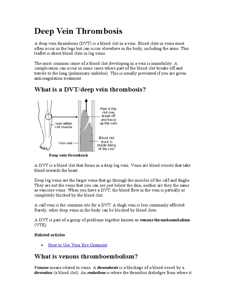 Deep Vein Thrombosis | PDF | Thrombosis | Vein