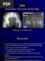 Screendem P KIrwan Spondyloarthropathy | PDF