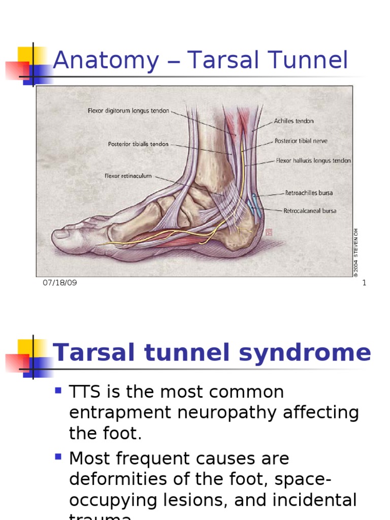 Tarsal Tunnel Syndrome Overview | PDF